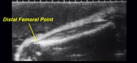 Femur Length – myminifellowship